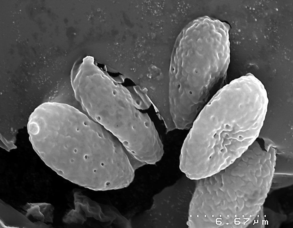 Spore Morphology – Boletineae