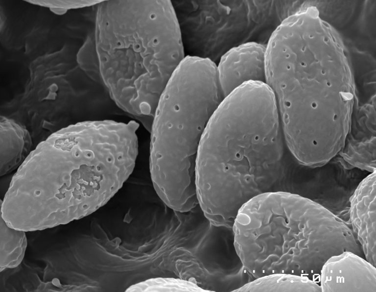 Spore Morphology – Boletineae